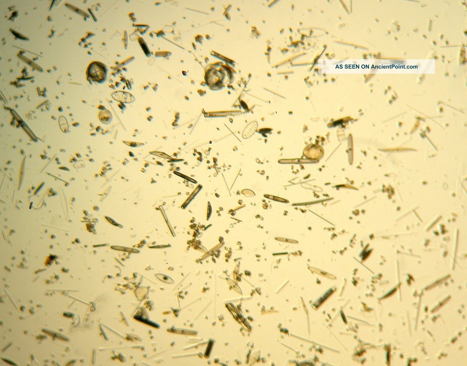 diatom strew under microscope